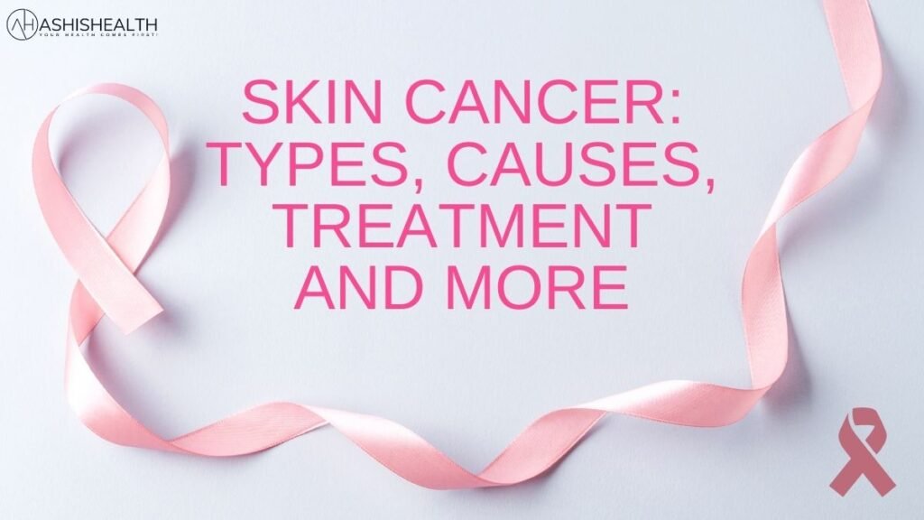 Skin Cancer: Types, Causes, Treatment and more - AshisHealth Guide to ...