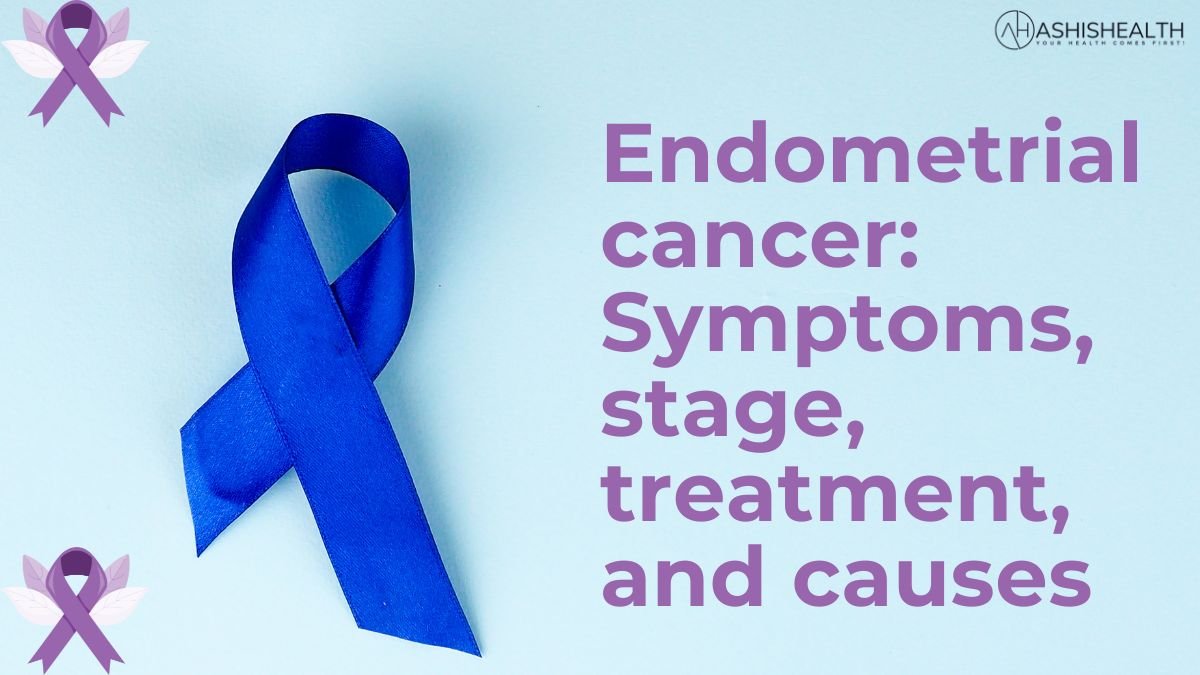 Endometrial Cancer Symptoms Stage Treatment And Causes